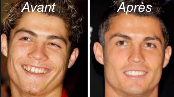 Cristiano Ronaldo & chirurgie esthétique : l'incroyable transformation